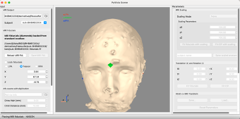 EEG-fMRI Data Cleaning & Forward Solution – BC Children’s Research MRI Wiki